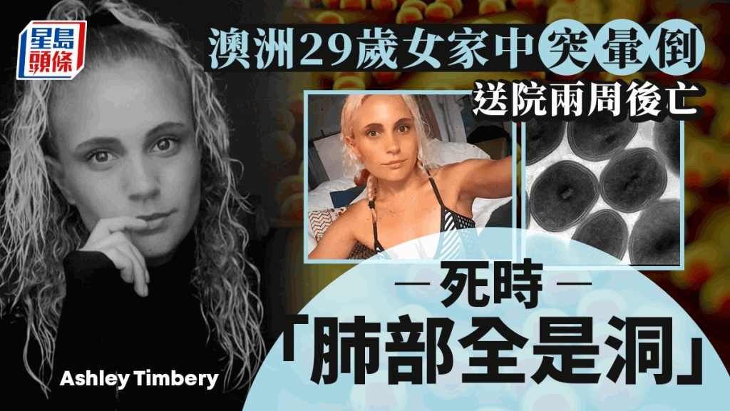 超級細菌｜澳洲29歲女染MRSA兩周後亡 死時肺部全是坑洞 | 事事如意生活網站