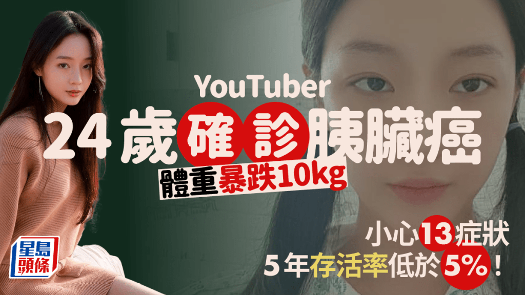胰臟癌｜YouTuber24歲已確診胰臟癌 體重暴跌10kg 小心13症狀 5年存活率恐低於5% | 事事如意生活網站